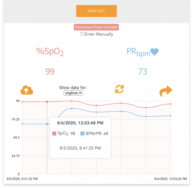 Building a Pulse Oximetry tracker using AWS Amplify and AWS serverless | AWS Compute Blog