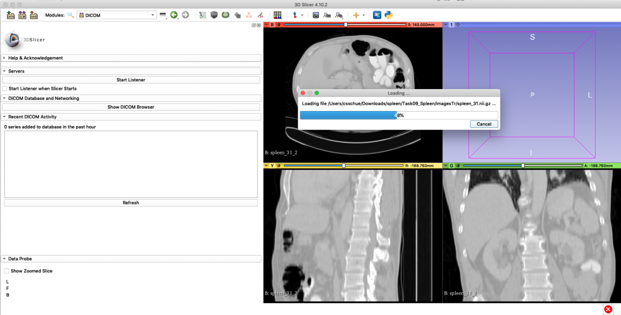 Accelerated model training and AI assisted annotation of medical images ...